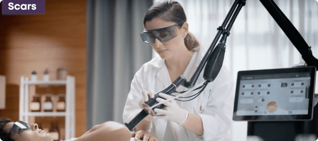 Laser Scar Removal | Alma Lasers Australia